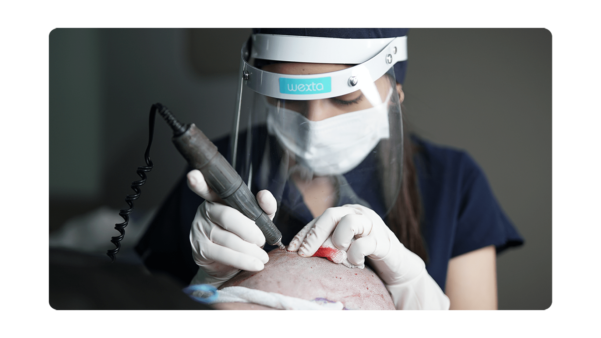 Fue Sapphire Method Long Hair Center Long Hair Center